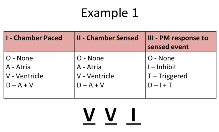 Pacemaker Essentials: What we need to know in the ED - CanadiEM