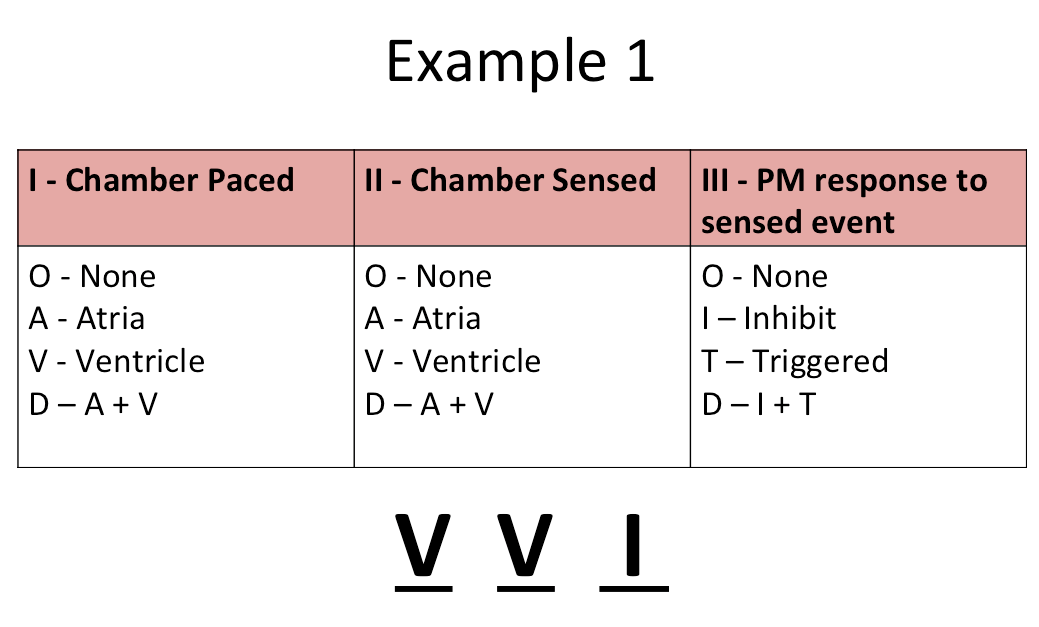 Pacemaker Essentials: What we need to know in the ED - CanadiEM