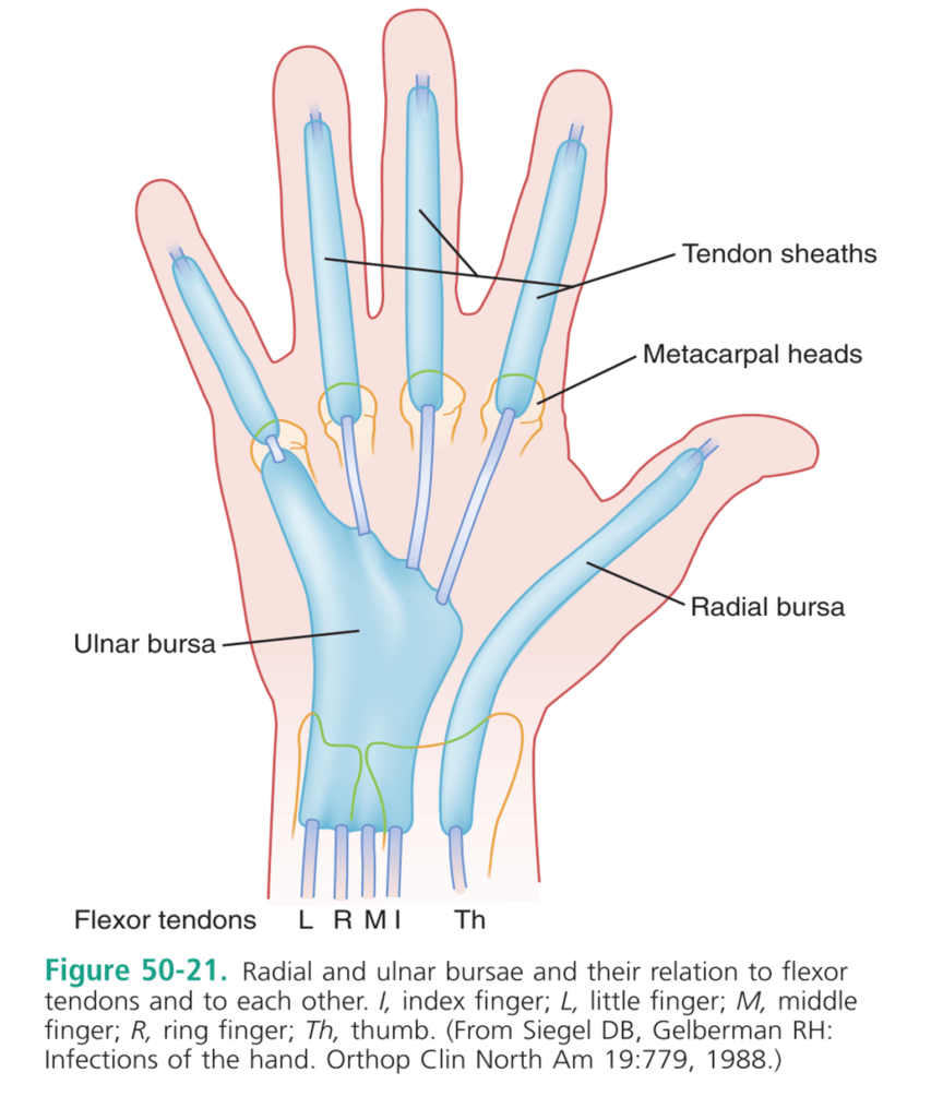 CRACKCast E050 – Orthopedics – Hand Injuries - CanadiEM