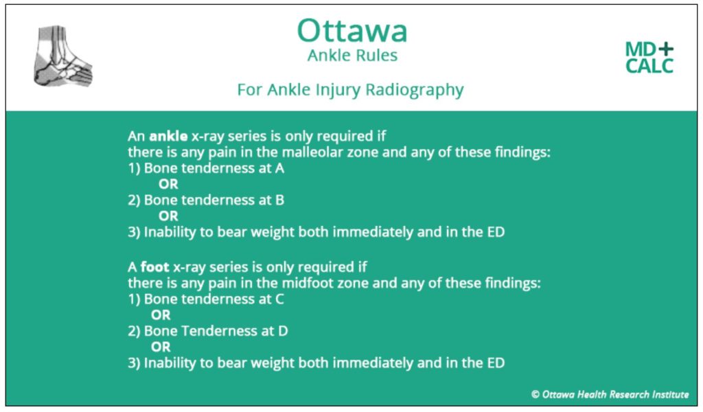 CRACKCast E058 – Ankle and Foot - CanadiEM